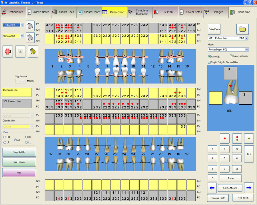 TCE Perio Chart Large Screen View